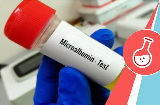 Những điều cần biết về Microalbumin niệu | VIAM